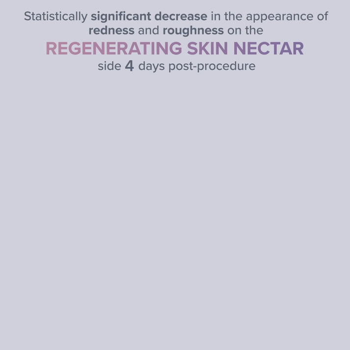 Alastin - Regenerating Skin Nectar with TriHex Technology – Nova ...